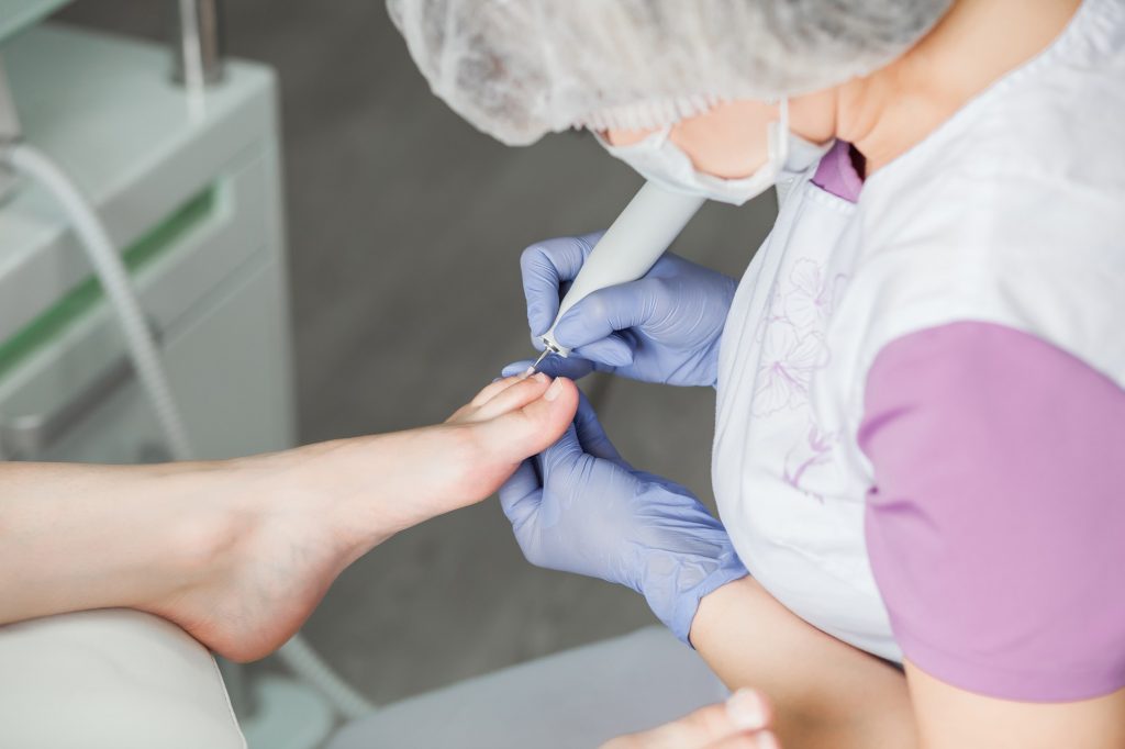 Chiropody and Foot Care Treatments in Sandiacre, Nottingham